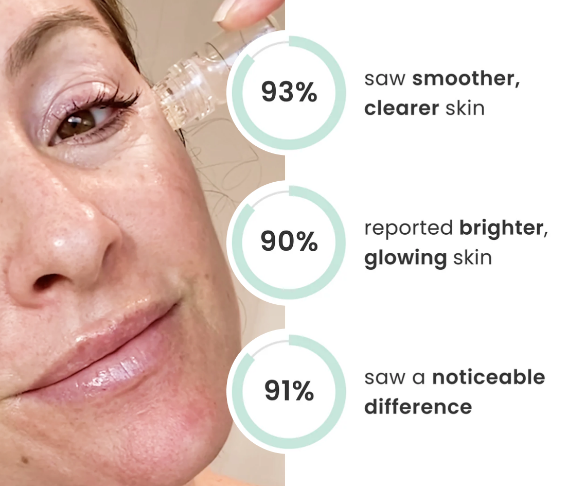 Micro-Infusion (Dark Spots) (2 Refill Treatments)