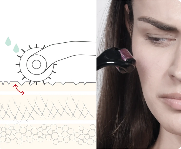 Qure™ Micro-Infusion Facial System