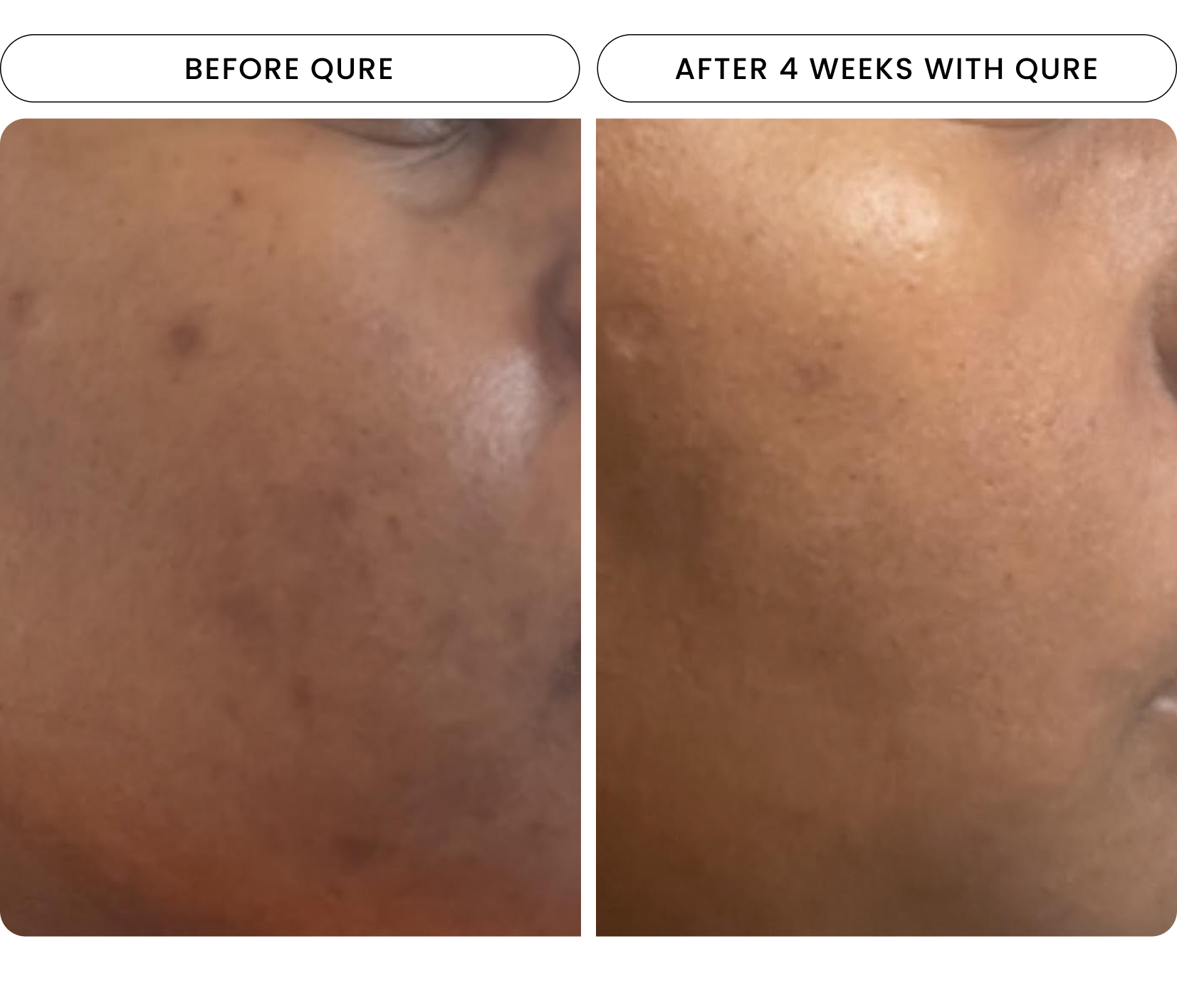 Red Light Mask | Rejuvenating LED Light Therapy | Qure