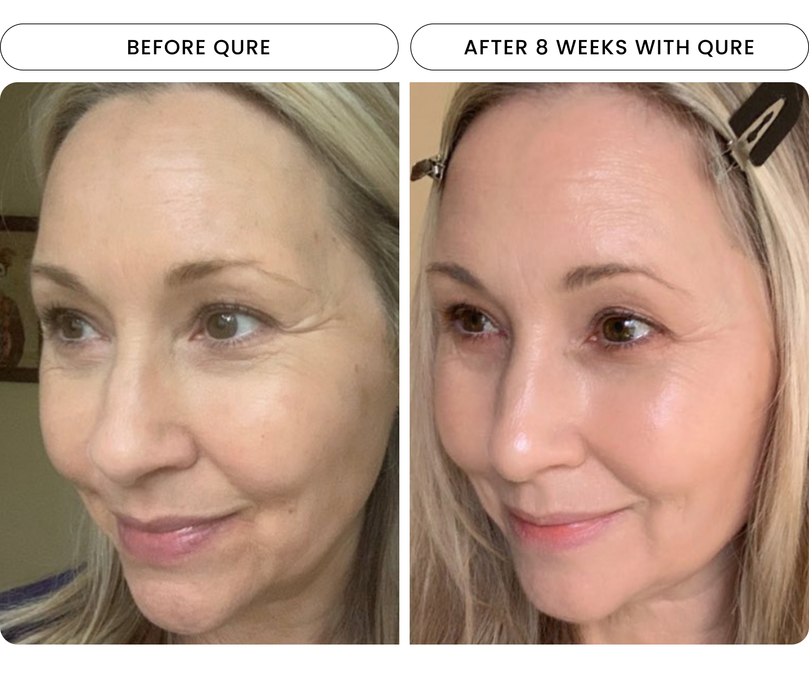 Red Light Mask | Rejuvenating LED Light Therapy | Qure