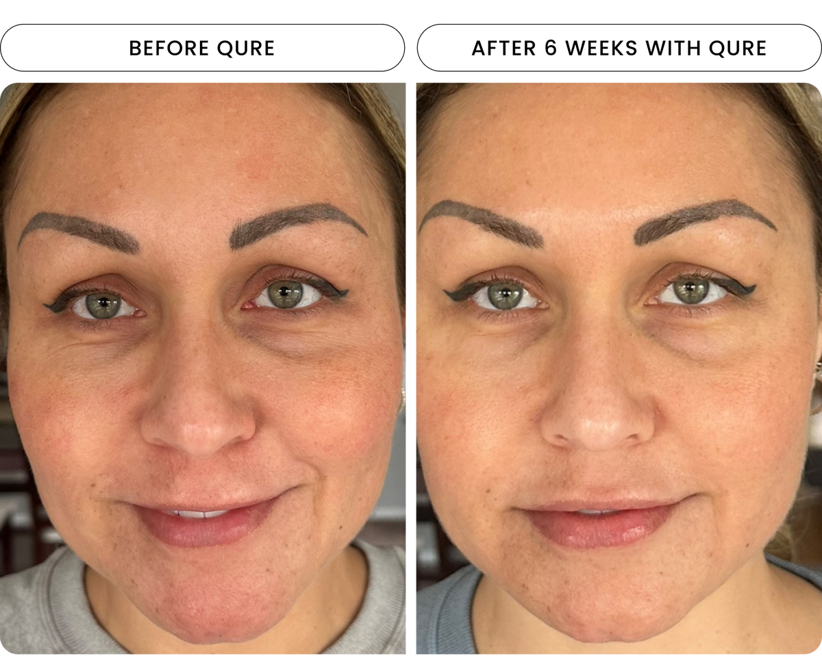 Red Light Mask | Rejuvenating LED Light Therapy | Qure