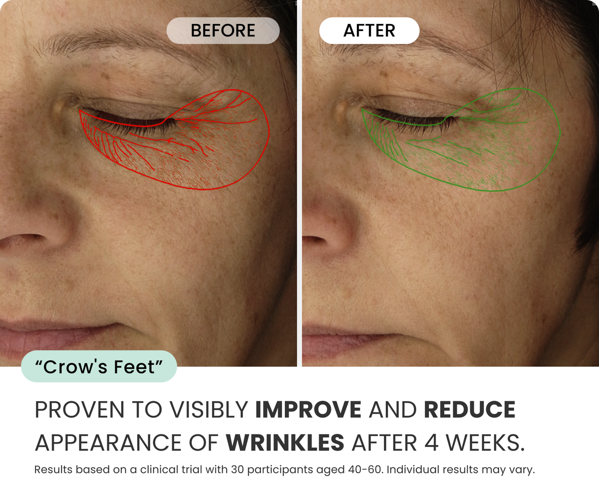 Micro Dart Patches | Target Under Eye & Other Facial Areas